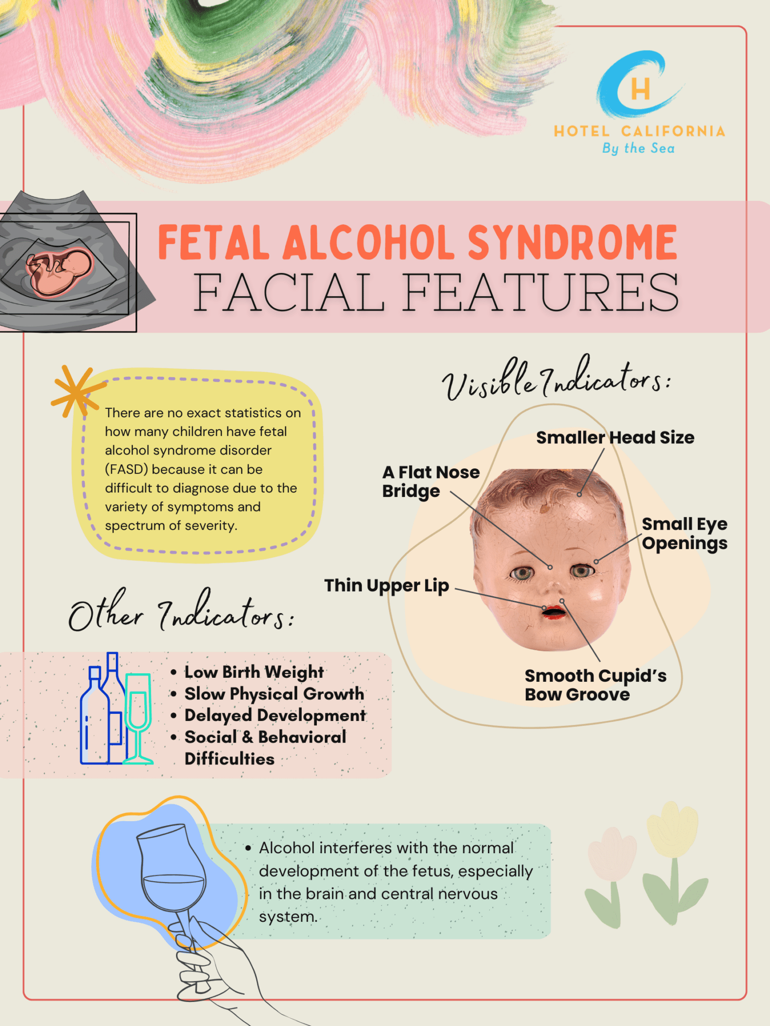 What Are Fetal Alcohol Syndrome Facial Features?